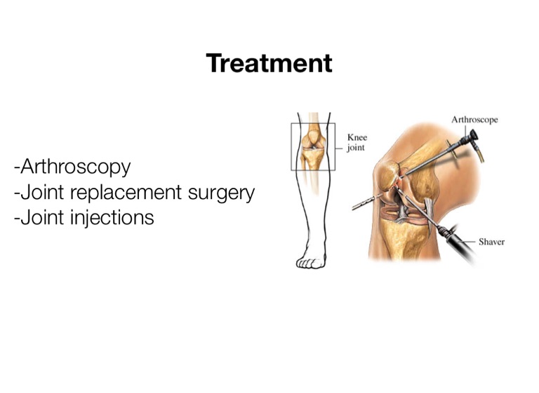 arthritis project - Screen 12 on FlowVella - Presentation Software for ...